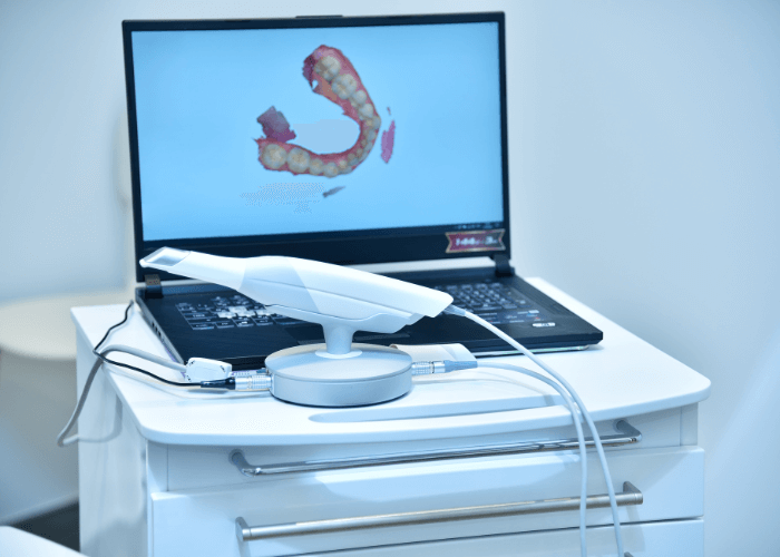 Intraoral Camera | Dental Technology | Ross Dental Studio | Prosper, TX